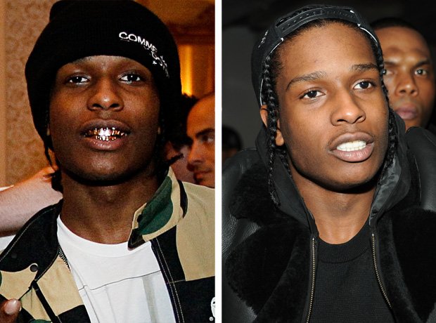 A$AP Rocky with and without teeth grillz. - Rappers With And Without ...